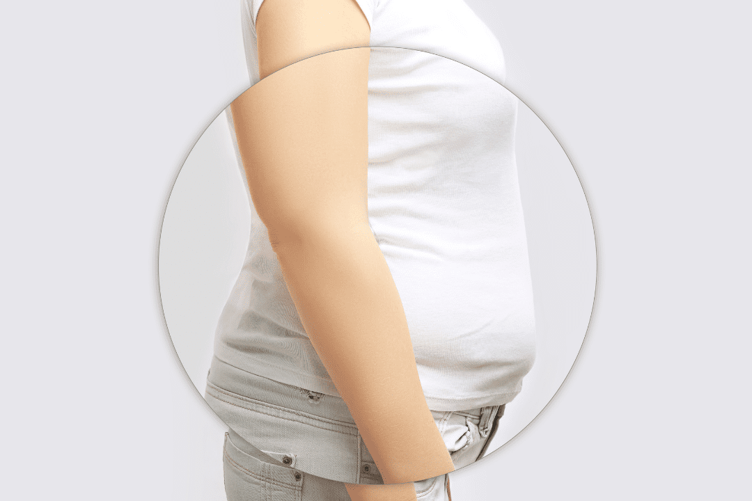 Is Fat-Freezing and Non-Surgical Body Sculpting Safe?